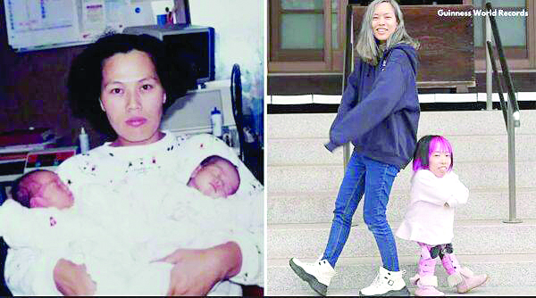 Twin sisters set record for biggest height difference - People Daily