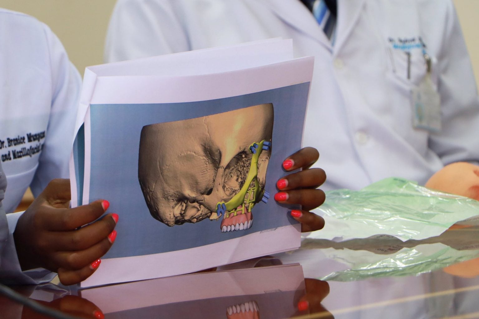 KNH to perform first-ever face reconstruction surgery on 7-year-old ...